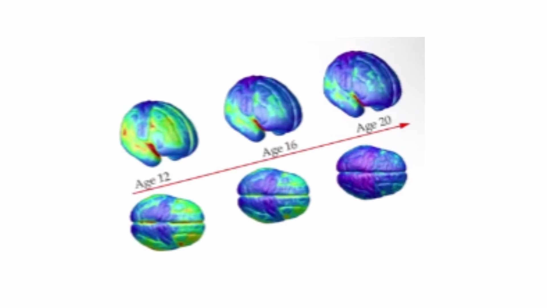 Amadurecimento do Córtex Pré-Frontal - YogIN Academy